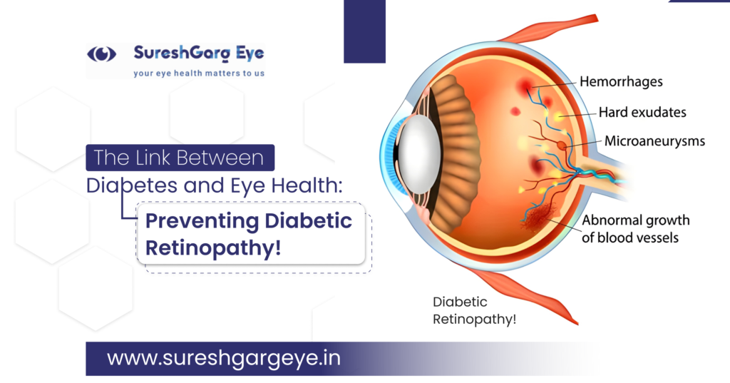 Diabetes & Your Eyes: Preventing Diabetic Retinopathy
